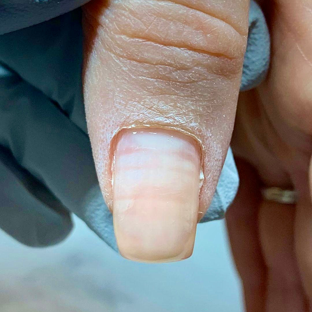 Nail Tech Guide: How to Prevent Rings of Fire – Erica's ATA